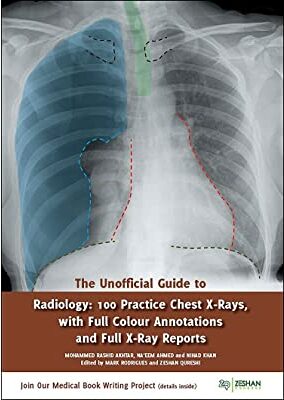 The Unofficial Guide to Radiology: 100 Practice Chest X-Rays (Color ...